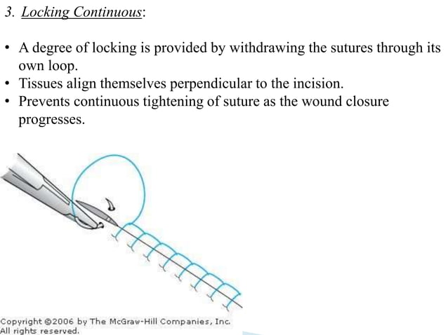 Suturing Materials and Techniques | PPTX