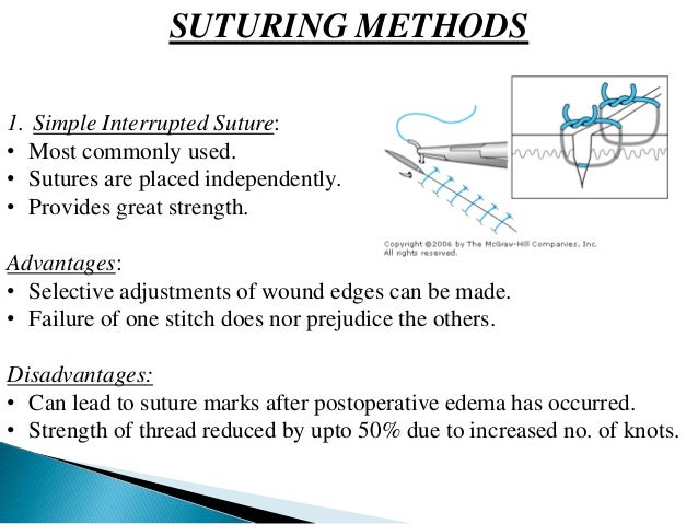 Suturing Materials and Techniques