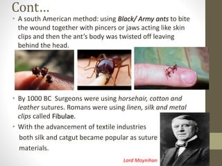 suture.pptx | First Aid | Injuries