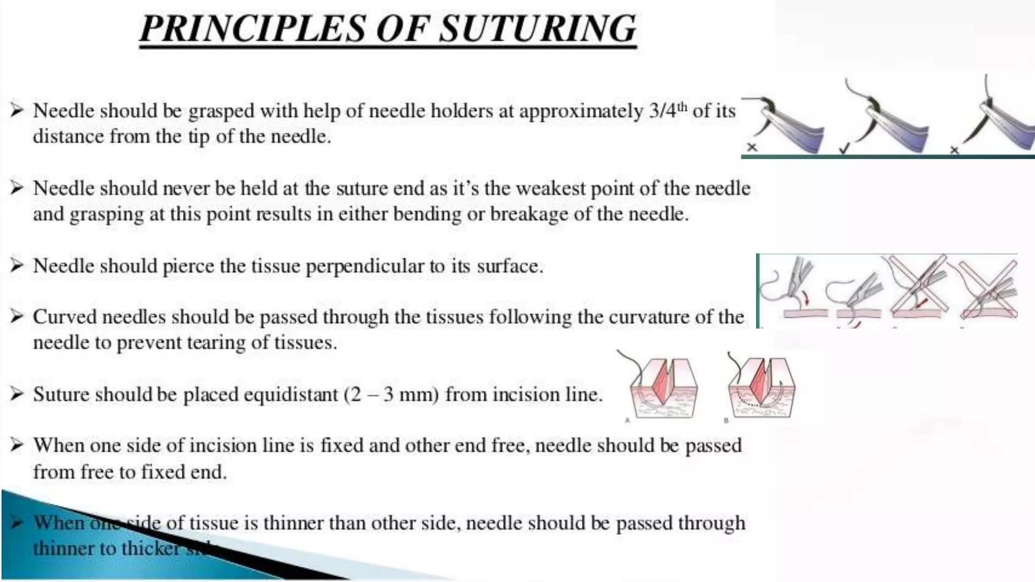 Dental Suturing: materials and techniques. | PPTX