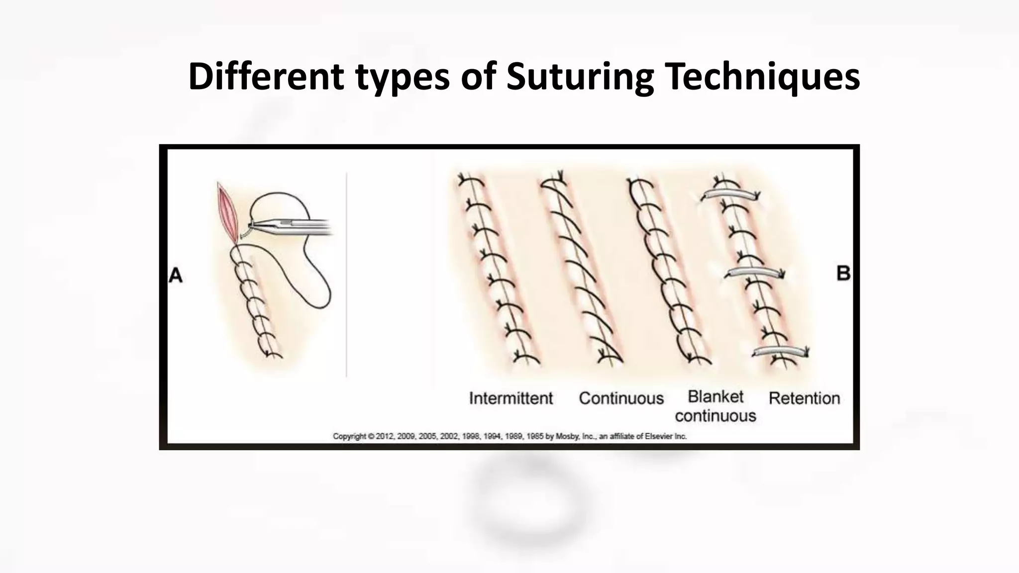 Dental Suturing: materials and techniques. | PPTX
