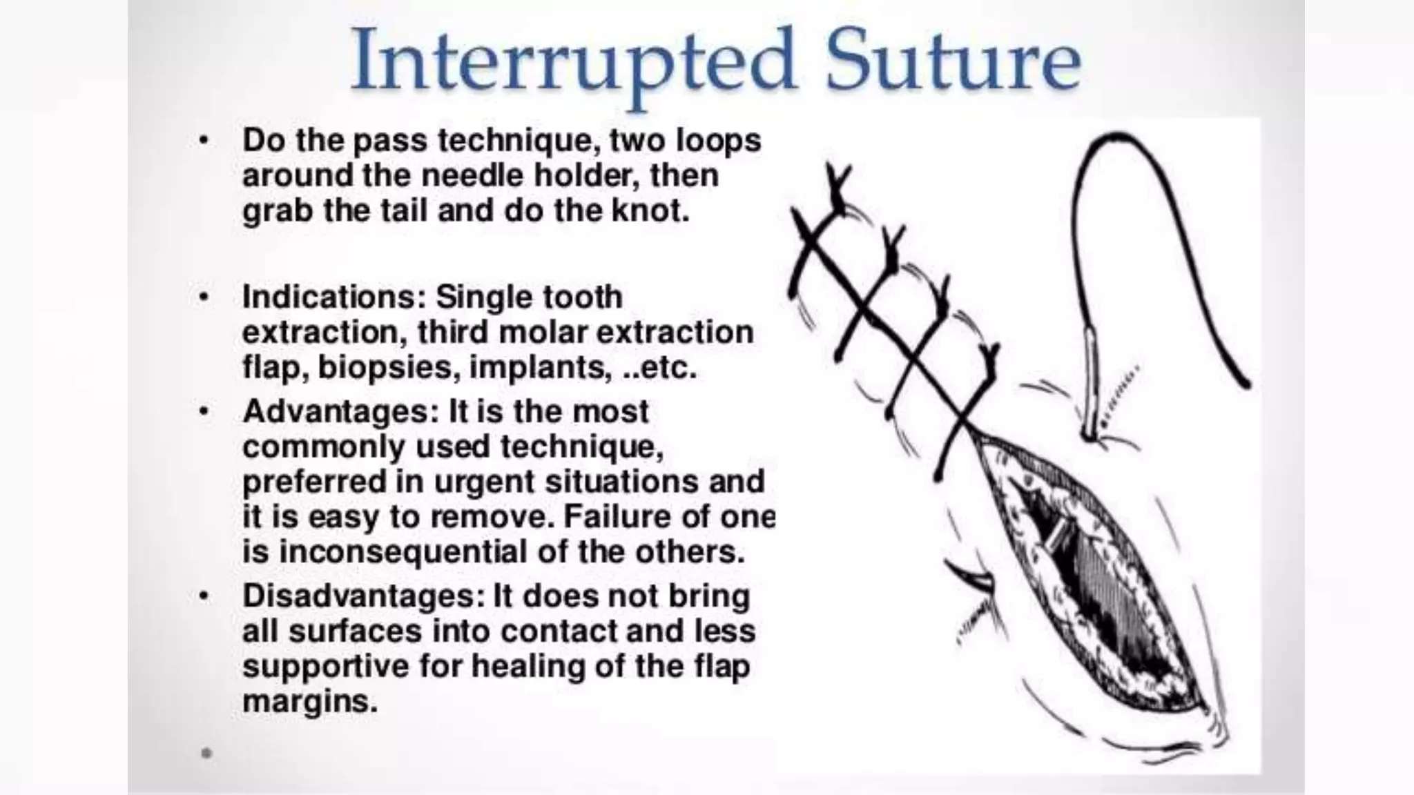 Dental Suturing: materials and techniques. | PPTX