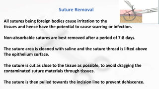 Dental Suturing: materials and techniques. | PPTX