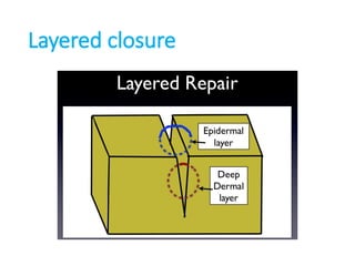 SUTURE AND SUTURING TECHNIQUES IN SURGERY | PPTX