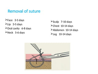SUTURE AND SUTURING TECHNIQUES IN SURGERY | PPTX