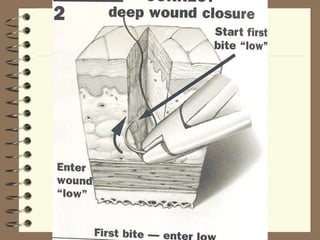 Suture Basics | PPT