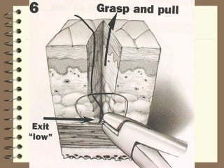 Suture Basics | PPT