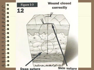 Suture Basics | PPT