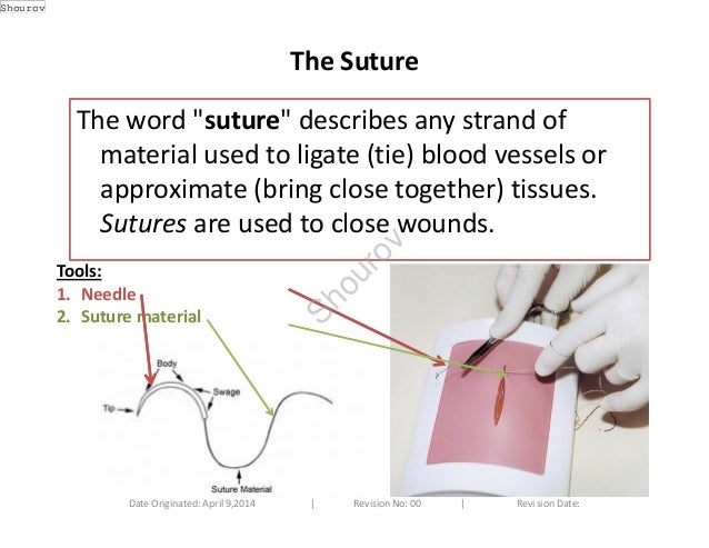 Surgical suture basics
