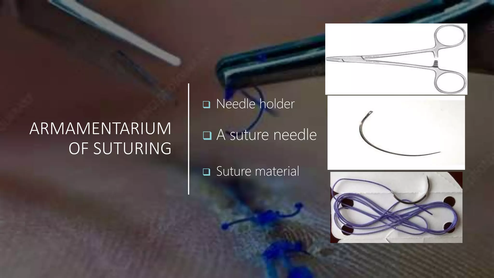 SUTURE MATERIAL.pptx