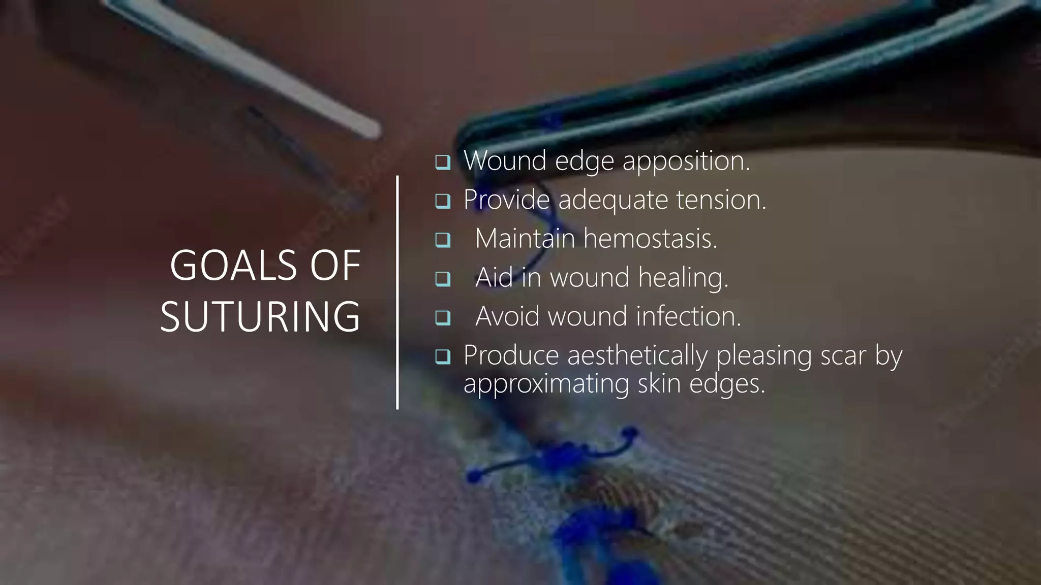 SUTURE MATERIAL.pptx