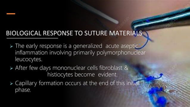 suturematerial-230605132806-5a662b5c 2.pdf