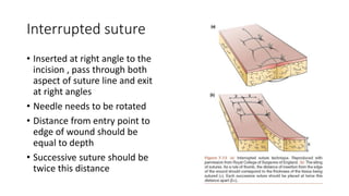 Suture material and techniques.pptx contains various suture material ...