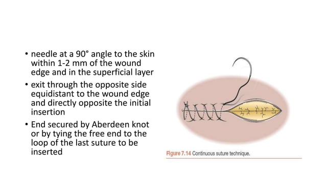 Suture material and techniques.pptx contains various suture material ...