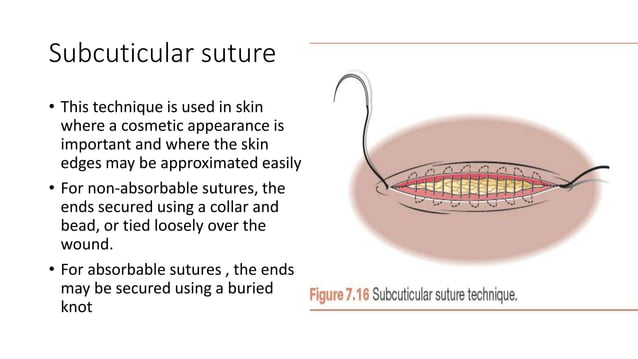 Suture material and techniques.pptx contains various suture material ...