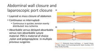 Suture material and techniques.pptx contains various suture material ...