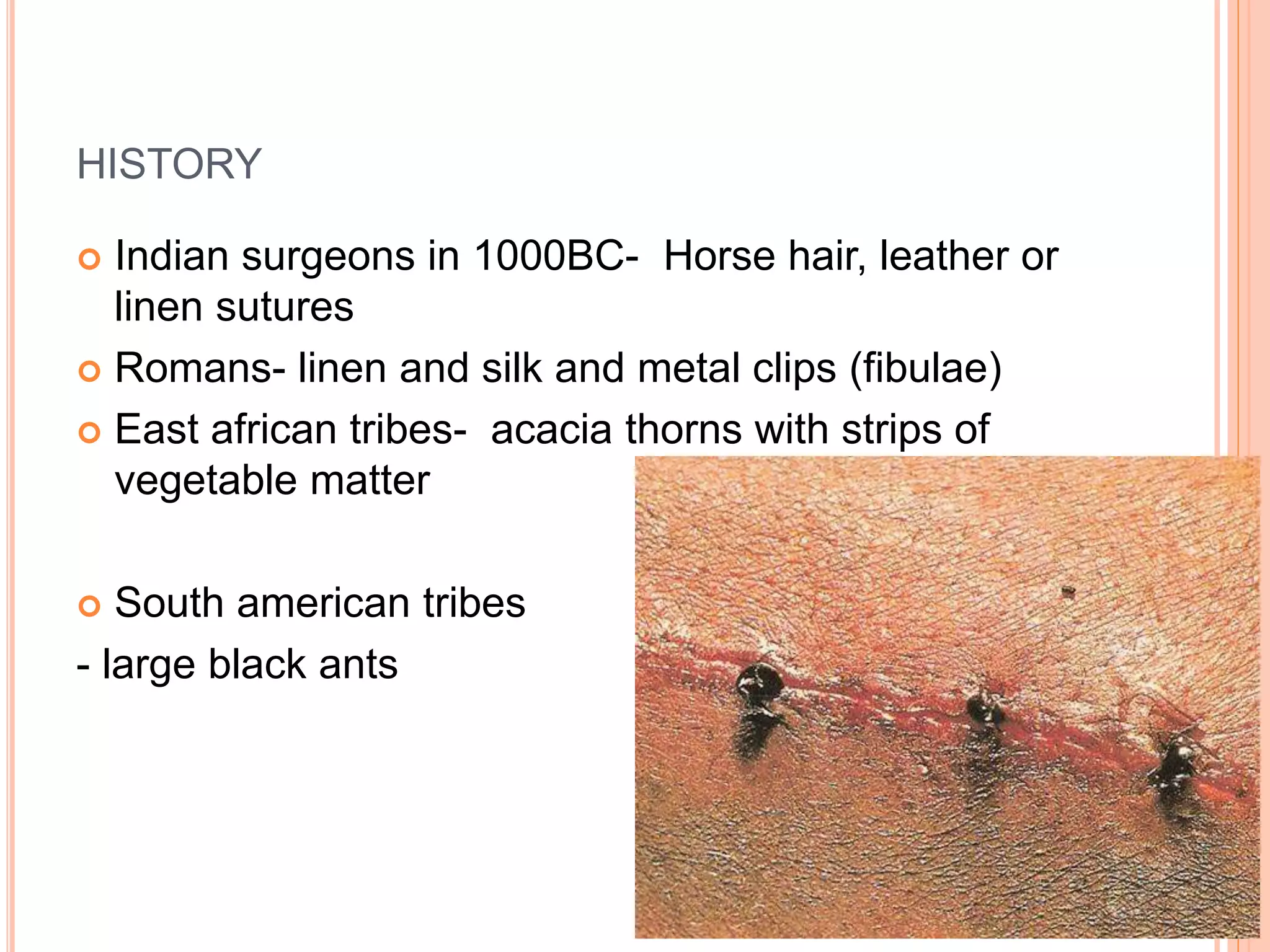 Surgical Suture needles and materials | PPTX