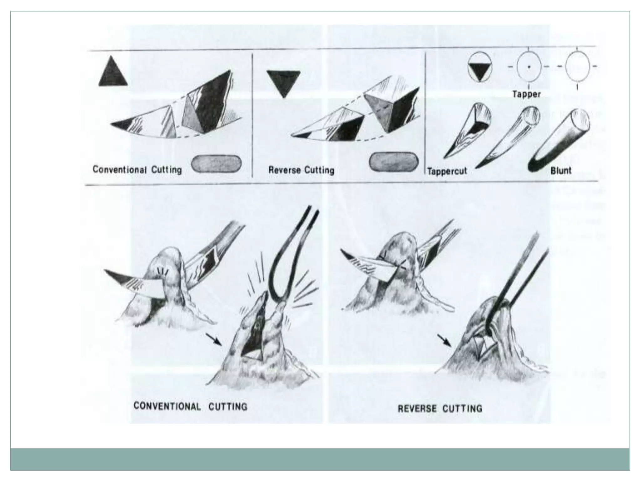 Suture materials | PPTX