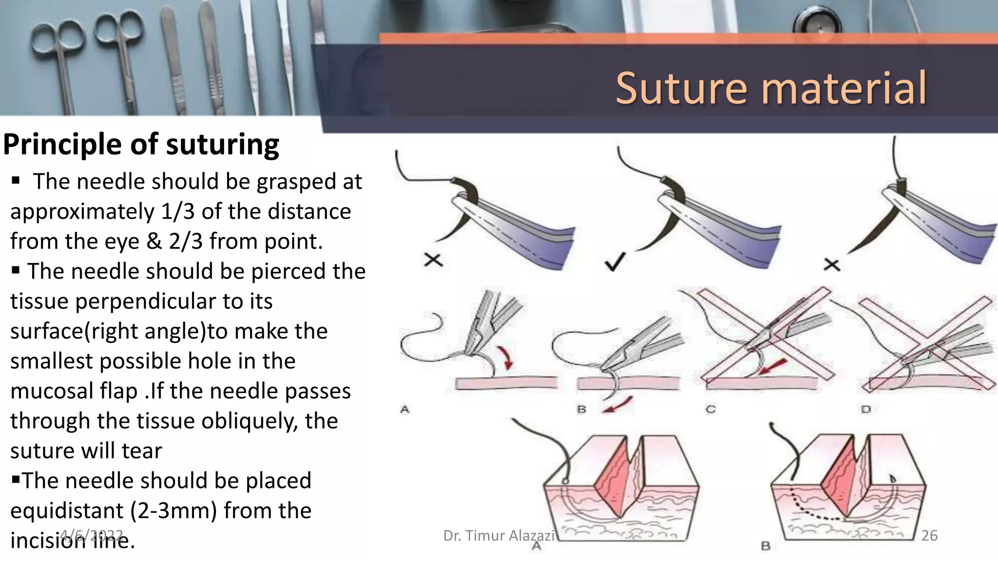 Suture materials and suturing techniques | PPTX
