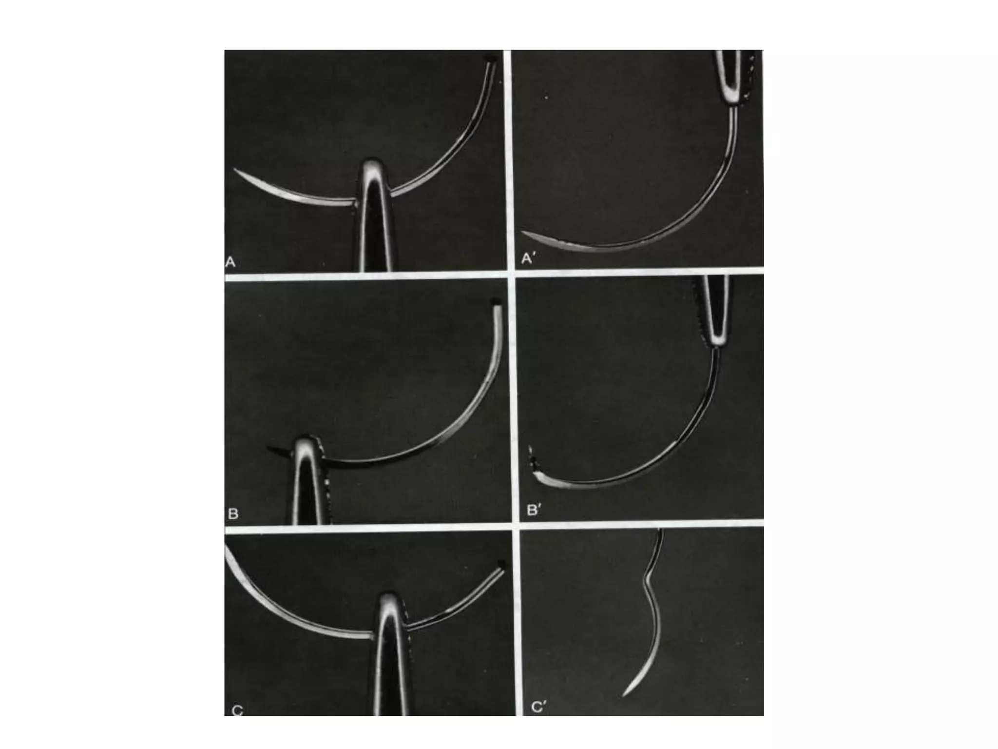 Suture materials and techniques | PPTX