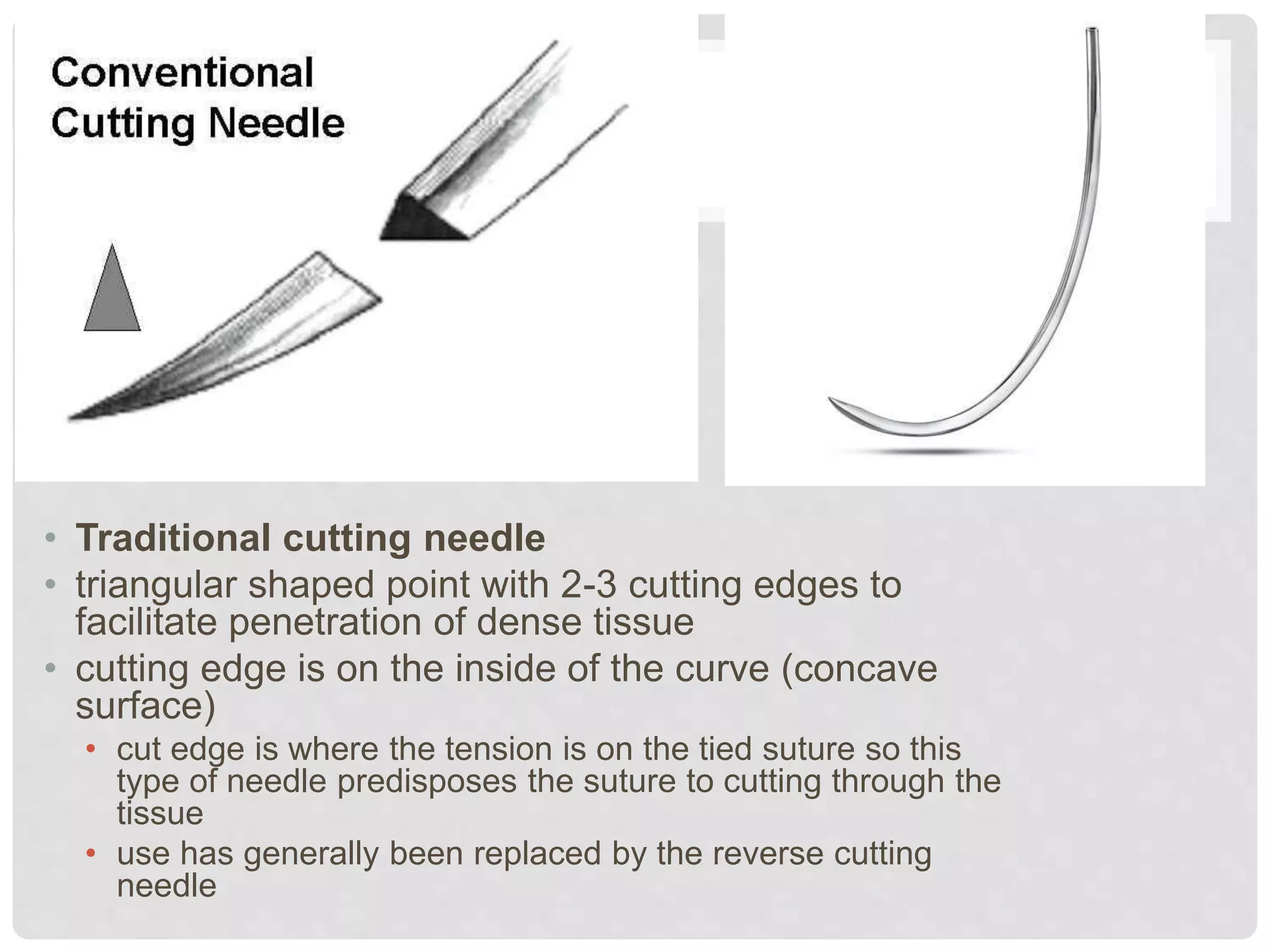 Suture materials and techniques | PPTX
