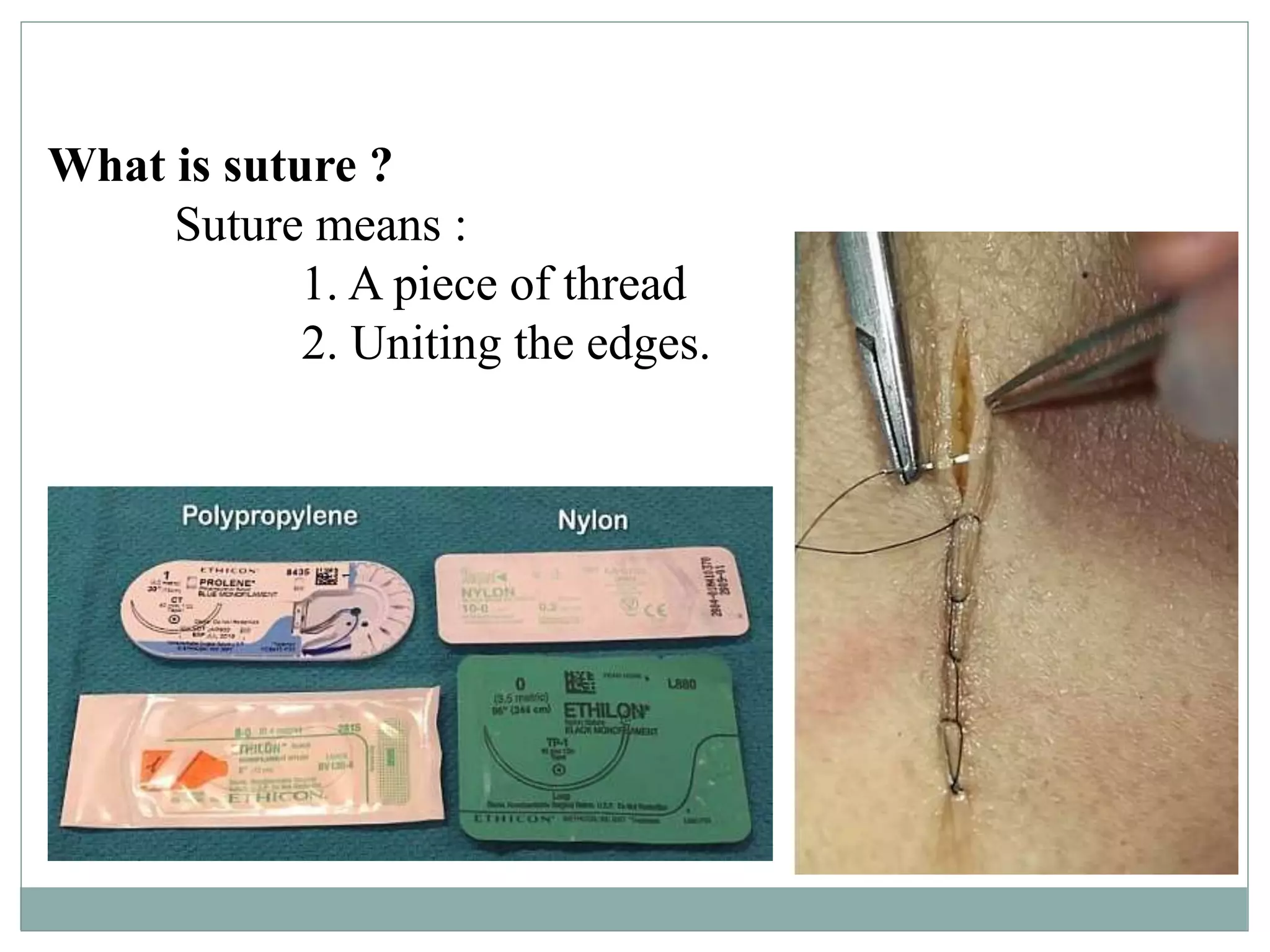 Suture materials, classification &usage | PPTX