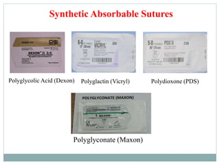 Suture materials, classification &usage | PPTX