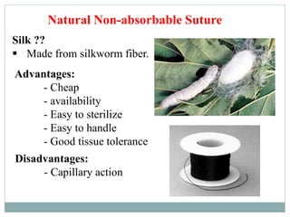 Suture materials, classification &usage | PPTX