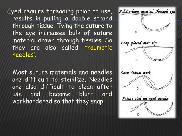 Suture material & suturing technique | PPTX