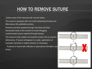 Suture material & suturing technique | PPTX