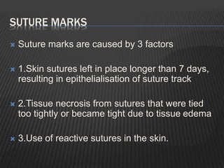 Suture material & suturing technique | PPTX