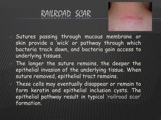Suture material & suturing technique | PPTX