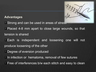 Continuous Locking Stitch