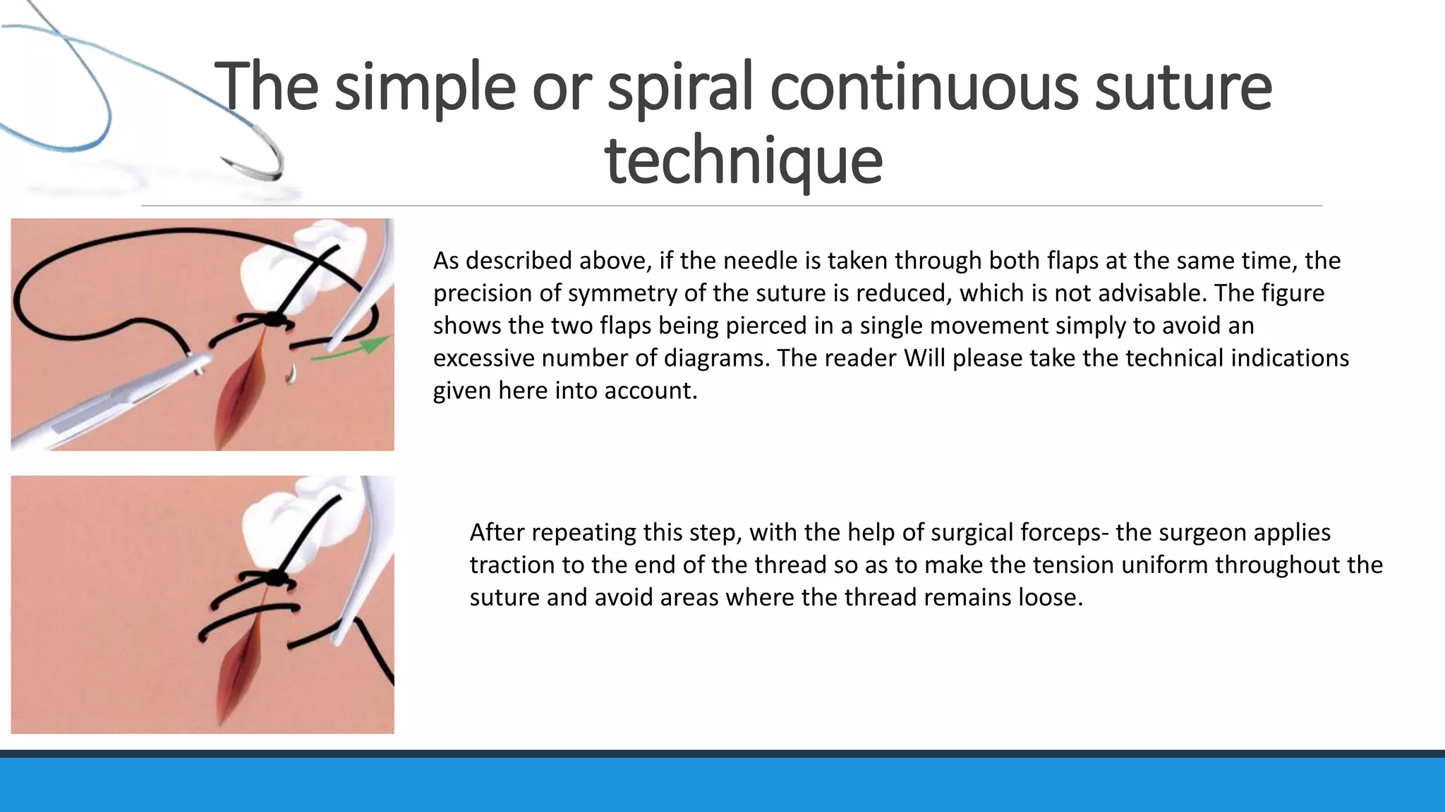 Suture material & suturing technique | PPTX