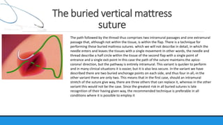 Suture material & suturing technique | PPTX