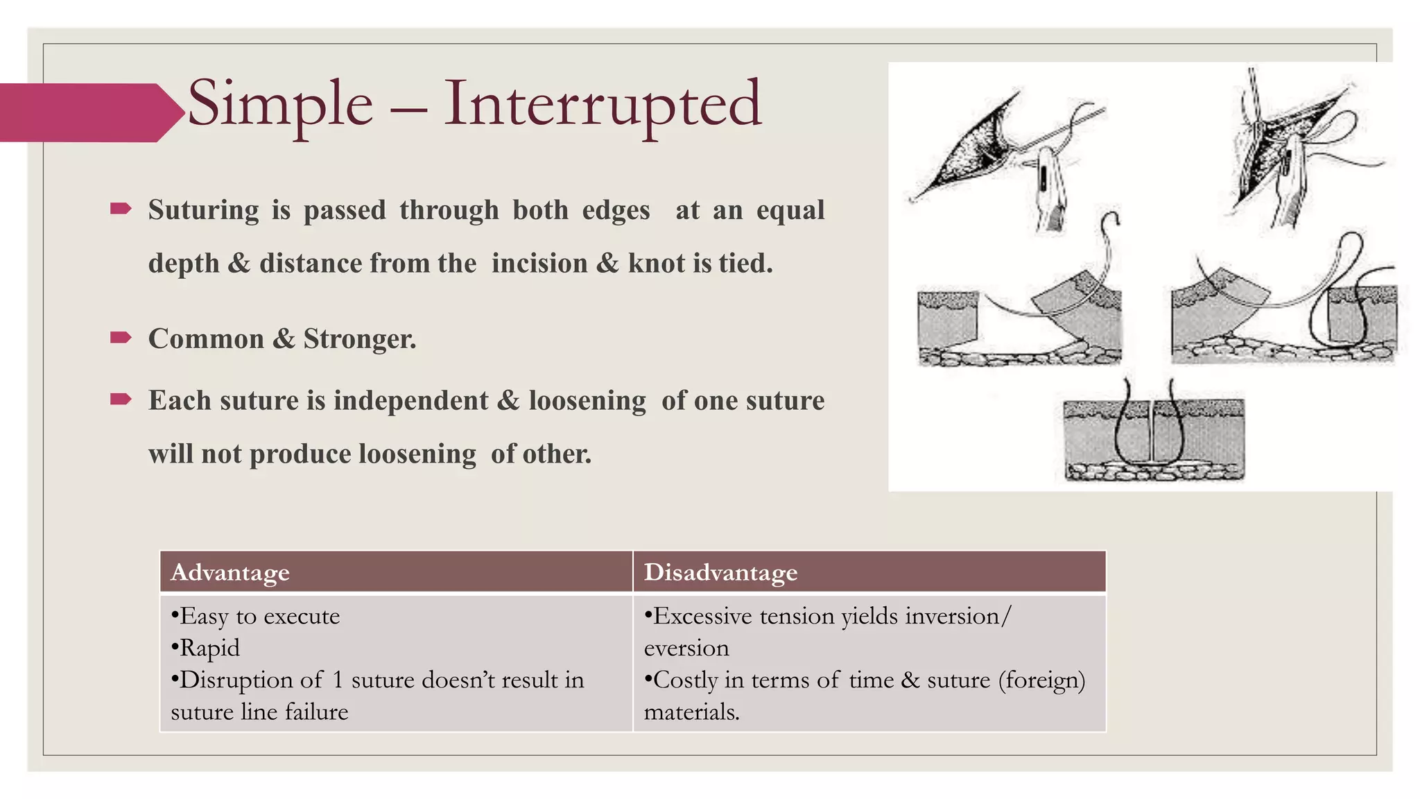 Suture, needle and knots | PPTX