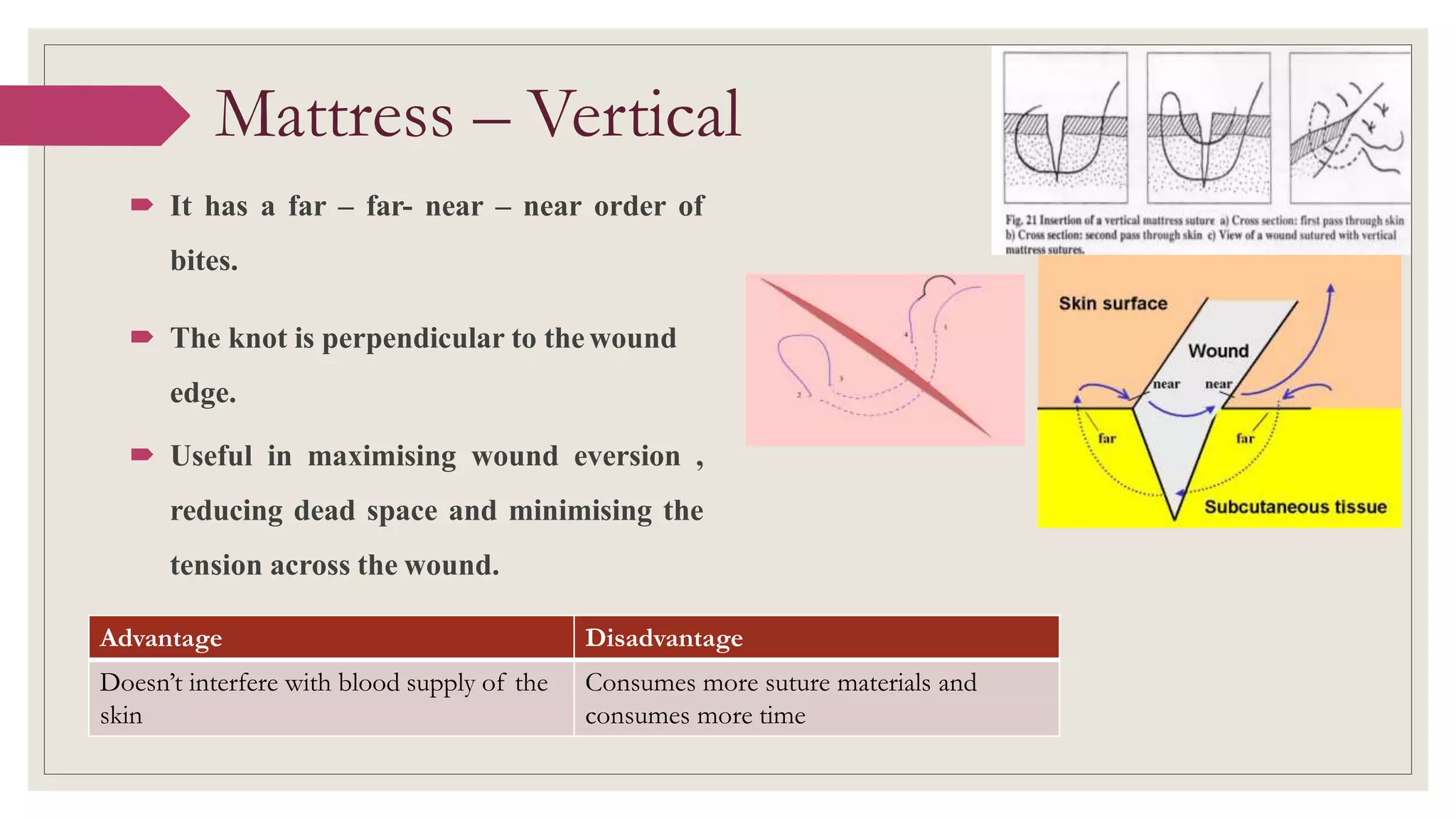 Suture, needle and knots | PPTX