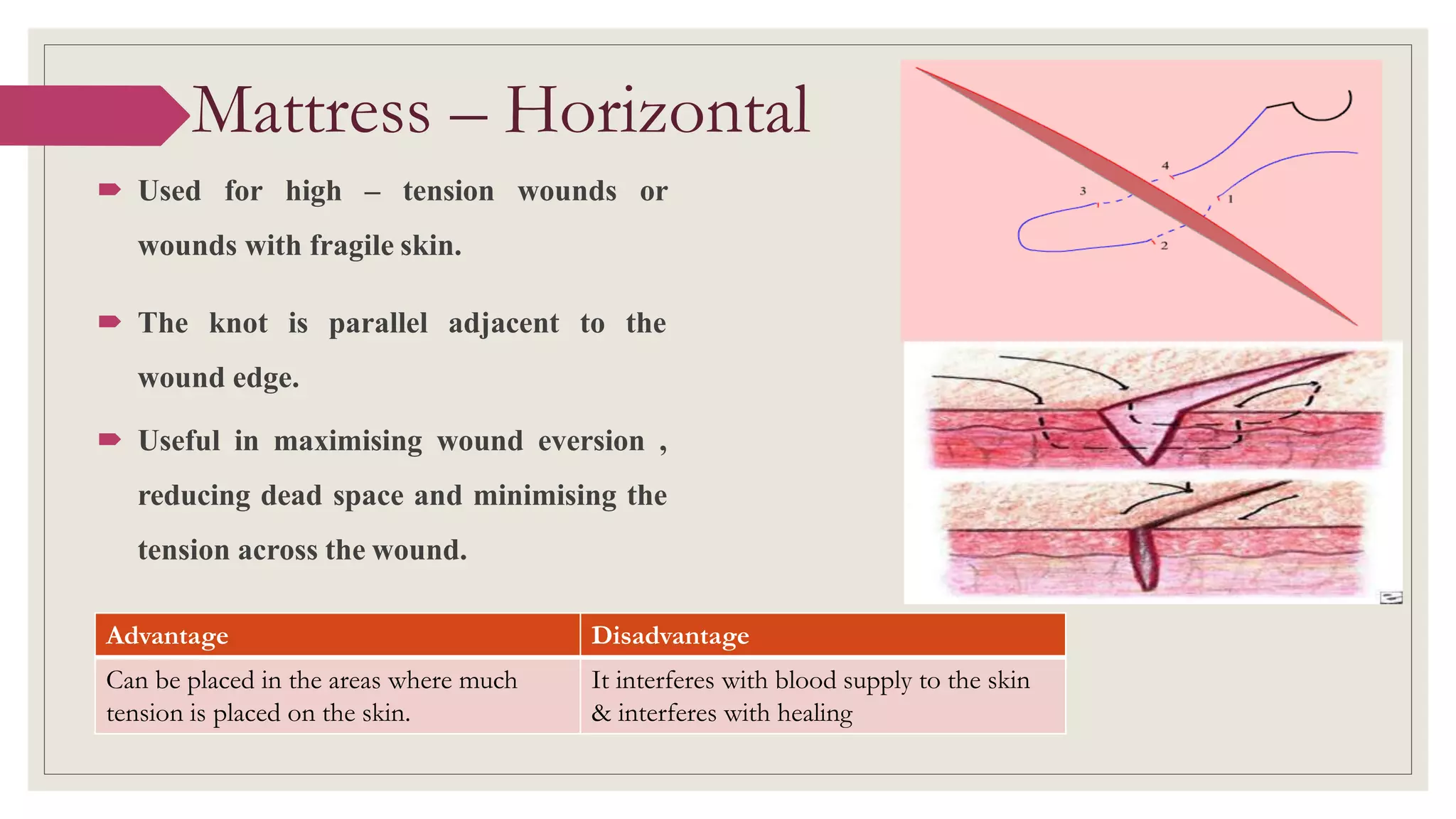 Suture, needle and knots | PPTX