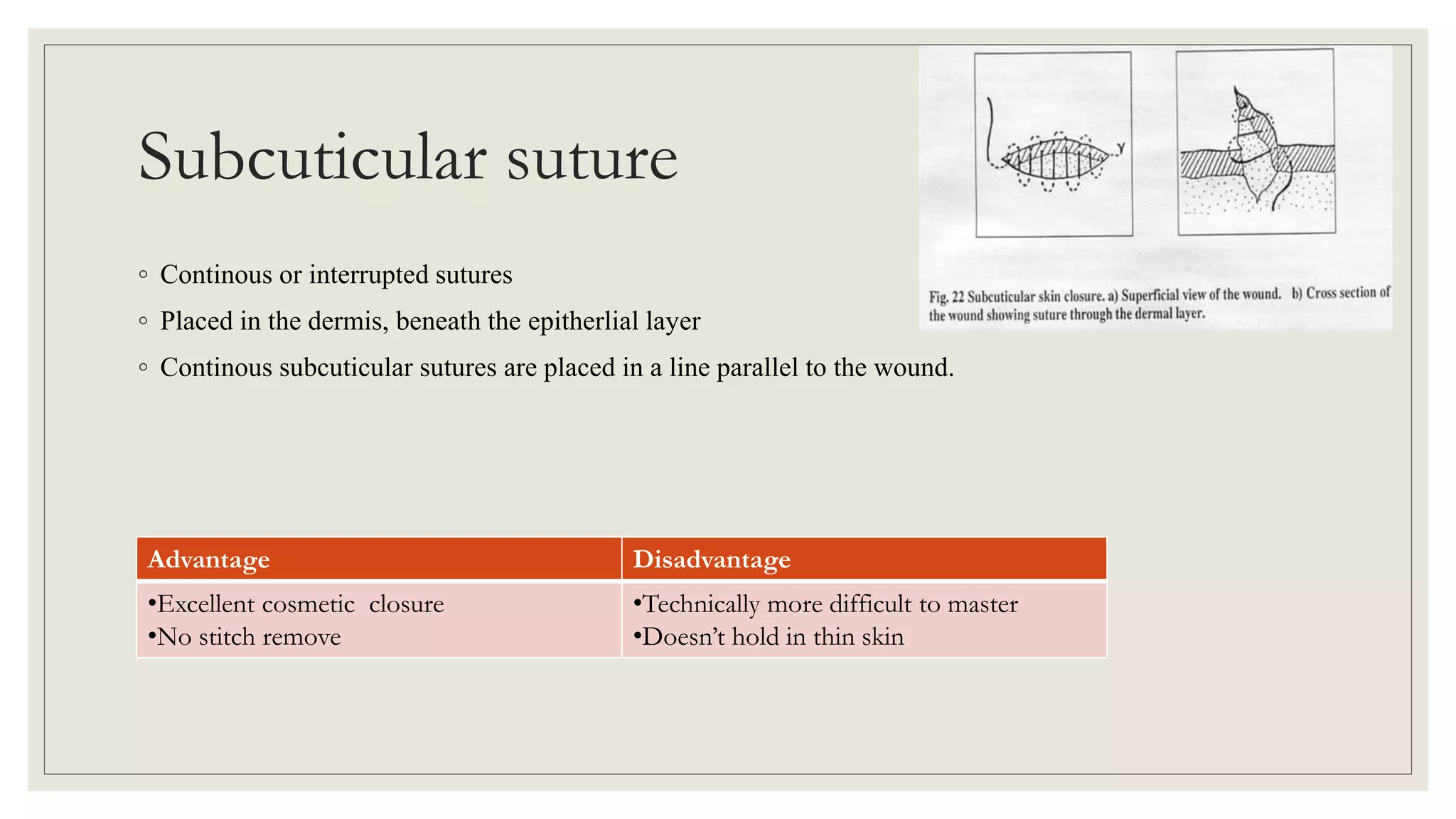 Suture, needle and knots | PPTX