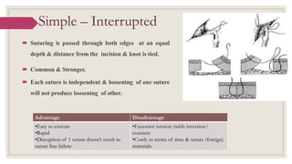 Suture, needle and knots | PPTX