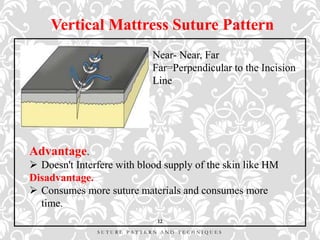 Suture paterns & knots | PPT