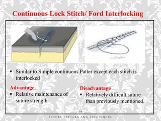 Suture paterns & knots | PPT