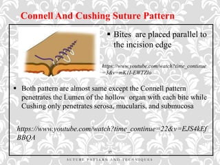 Suture paterns & knots | PPT