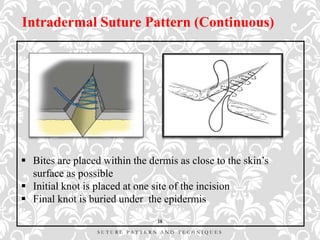 Suture paterns & knots | PPT