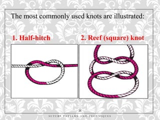 Suture paterns & knots | PPT