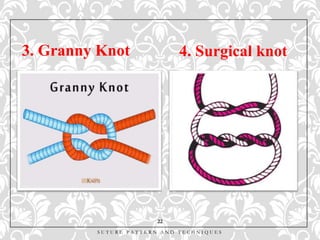 Suture paterns & knots | PPT