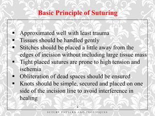 Suture paterns & knots | PPT