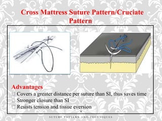 Suture paterns & knots | PPT
