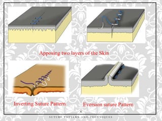 Suture paterns & knots | PPT