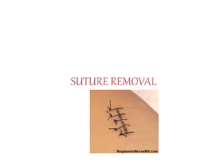 suture removal ppt.pptx medical surgical | PPTX